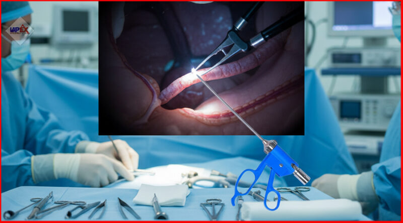 Laparoscopic Vs Open Surgery: Recovery, Costs, Outcomes